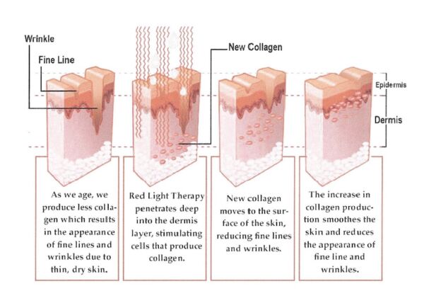 COLLAGEN PRODUCTION - Woscan Light